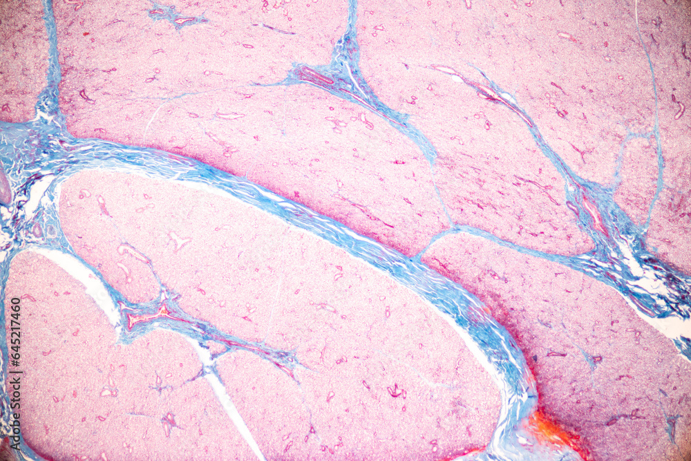 Anatomy and Histological Tonsil and Parotid Human cells under ...