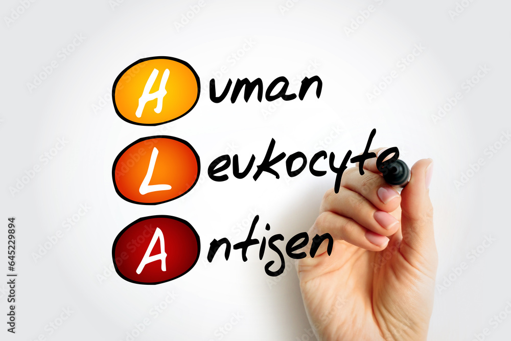 HLA Human Leukocyte Antigen - complex of genes on chromosome 6 in ...