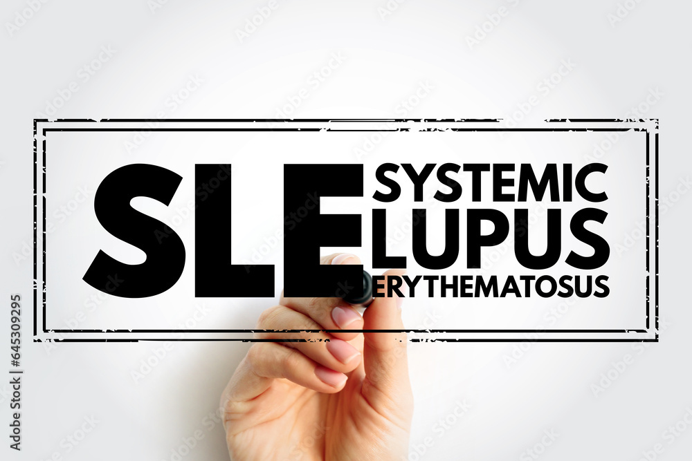 SLE Systemic Lupus Erythematosus - autoimmune disorder characterized by ...