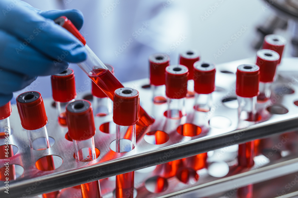 Hands of a doctor or female doctor collecting blood sample tubes from ...