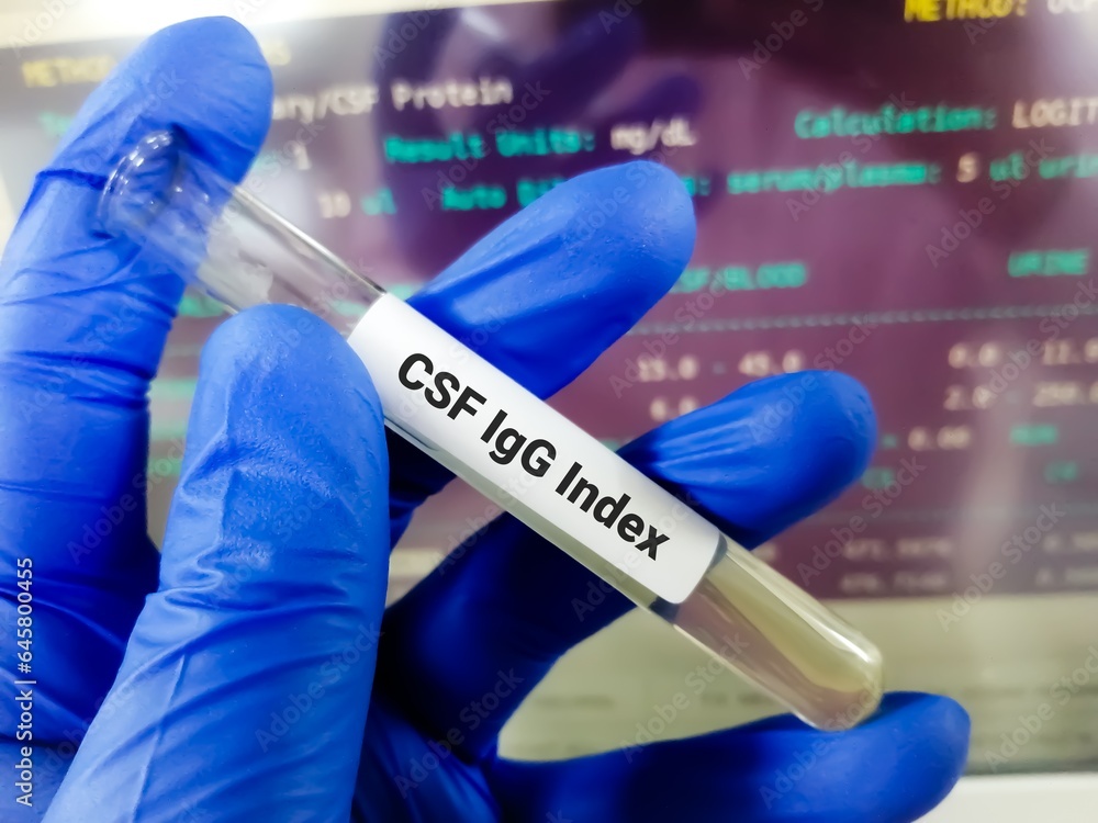 CSF IgG index measures the levels of IgG in cerebrospinal fluid. High levels of IgG may means an ...