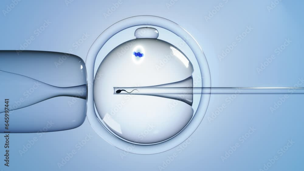 3D animation of Piezo-ICSI performed with spindle visualization. In ...