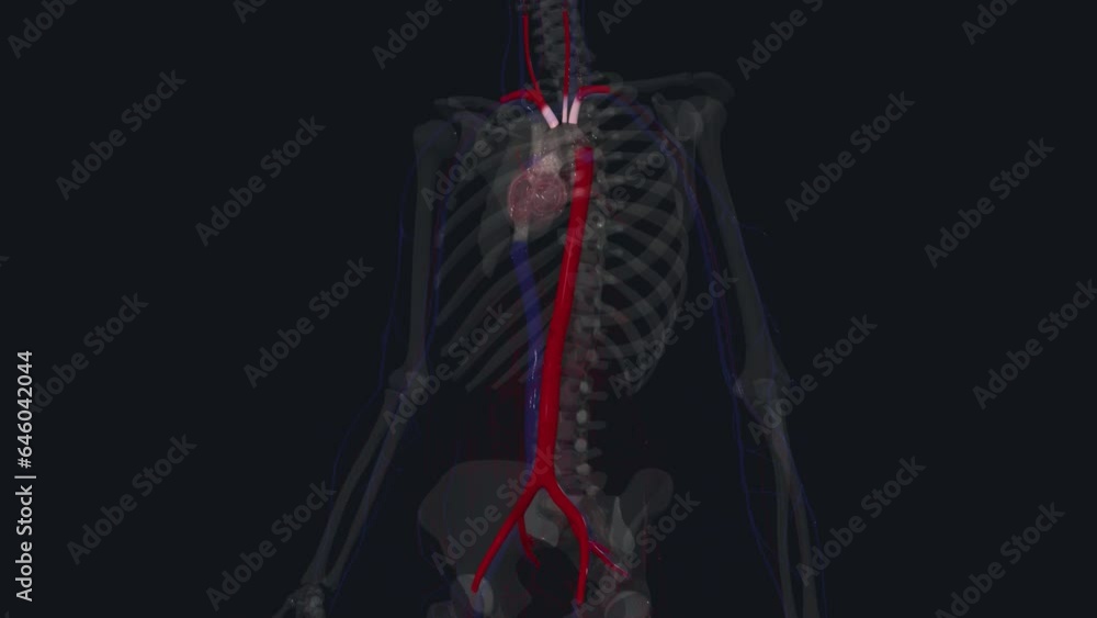 Major arteries of the body Aorta Head and neck arteries Torso arteries ...