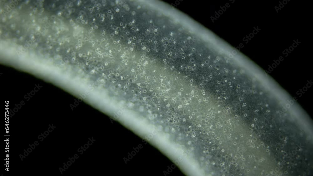 Tentacles of jellyfish Cyanea capillata under microscope, class ...