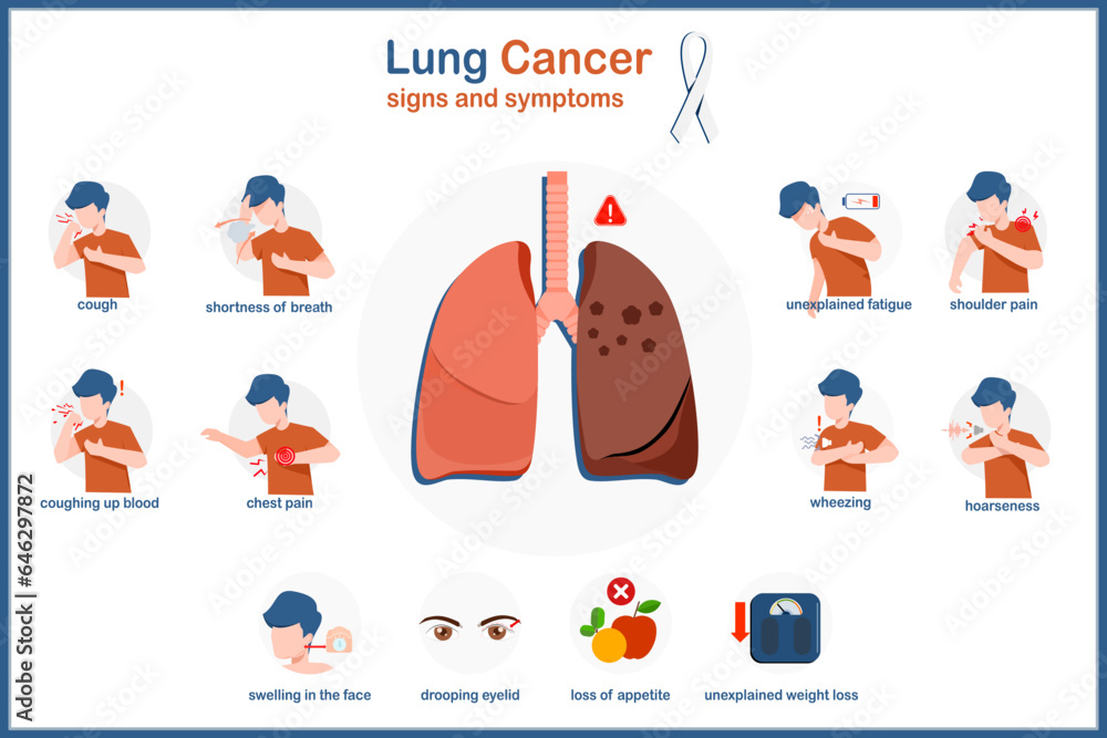 Chest Pain Shortness Of Breath Lung Cancer at Elaine Boehme blog