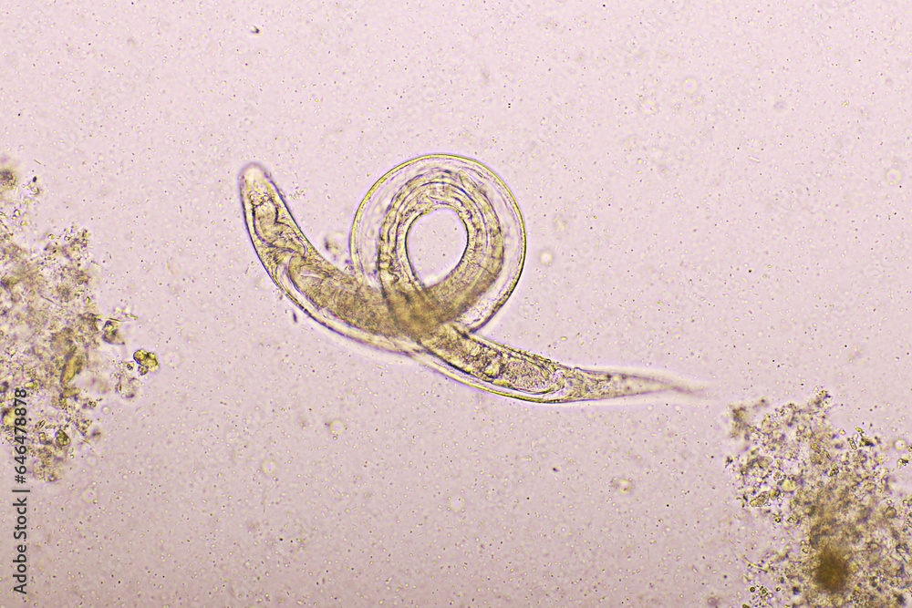 Strongyloides stercoralis or threadworm in human stool, analyze by ...