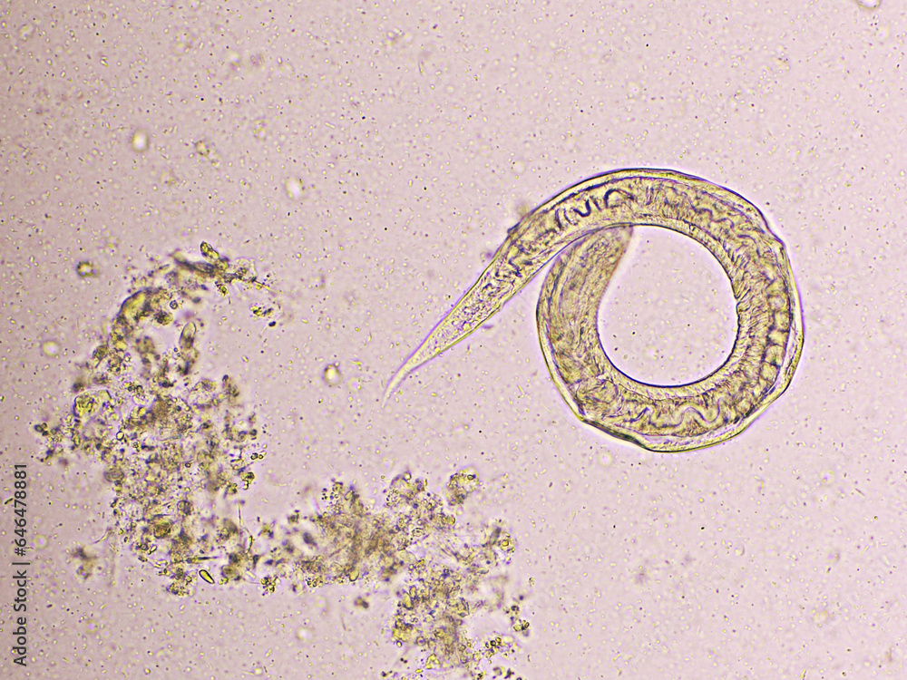 Strongyloides stercoralis or threadworm in human stool, analyze by ...