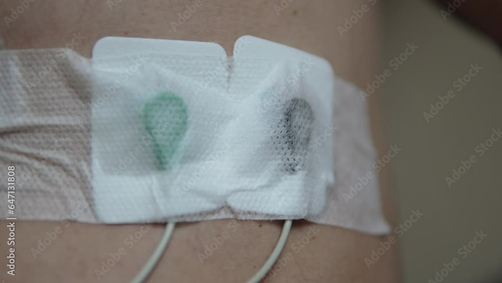 Two sensors with wires are fixed with plaster on man body in region of ... Two sensors with wires are fixed with plaster on man body in region of ...
