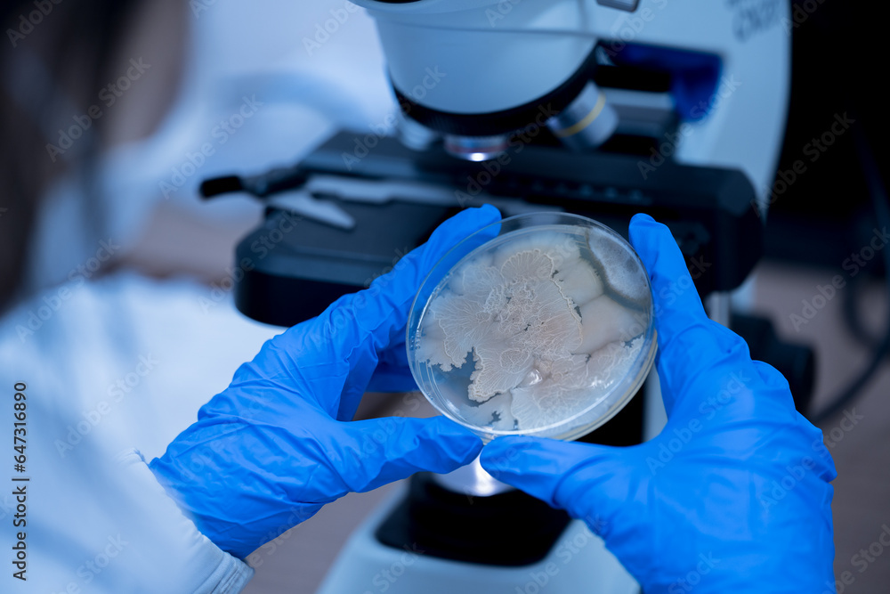Scientist holding agar plate for diagnosis bacterial or microorganism ...