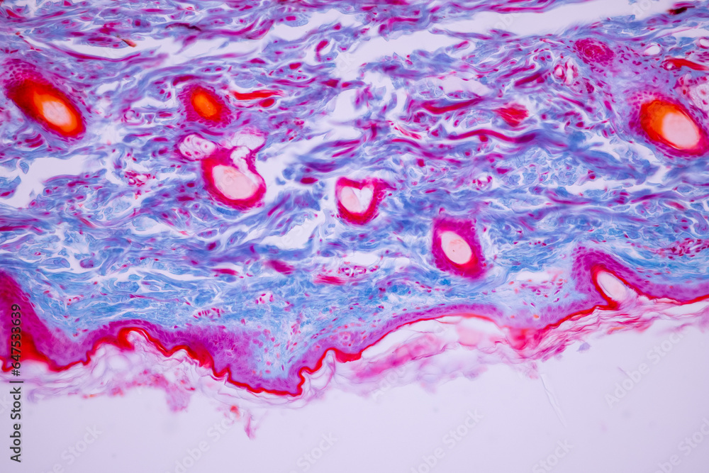 Backgrounds of Characteristics Tissue of Human scalp, Skin human from ...