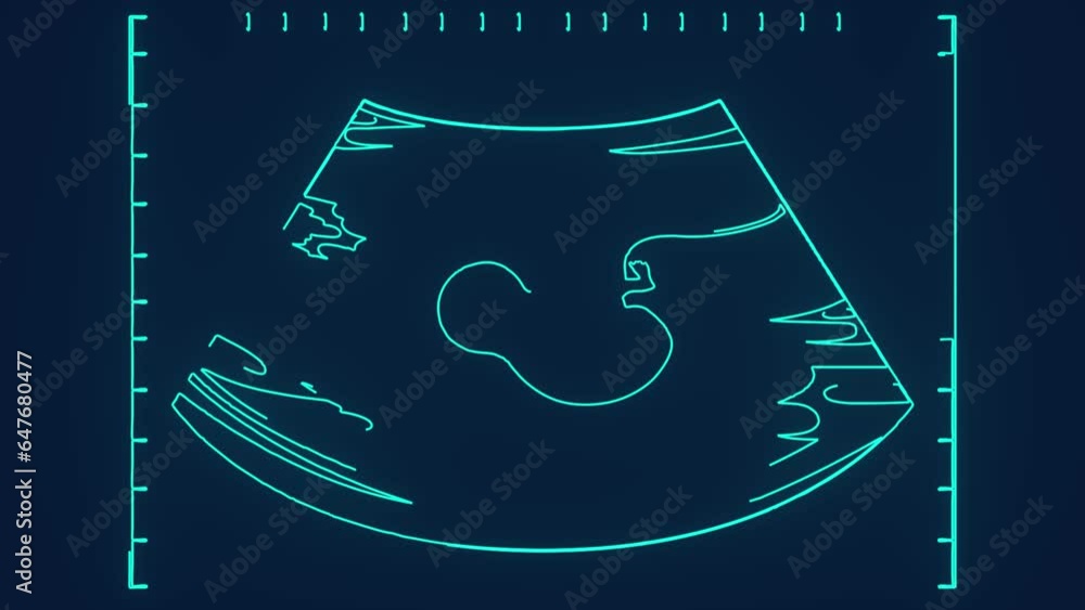 Ultrasound image of baby in pregnant women medical examination ...