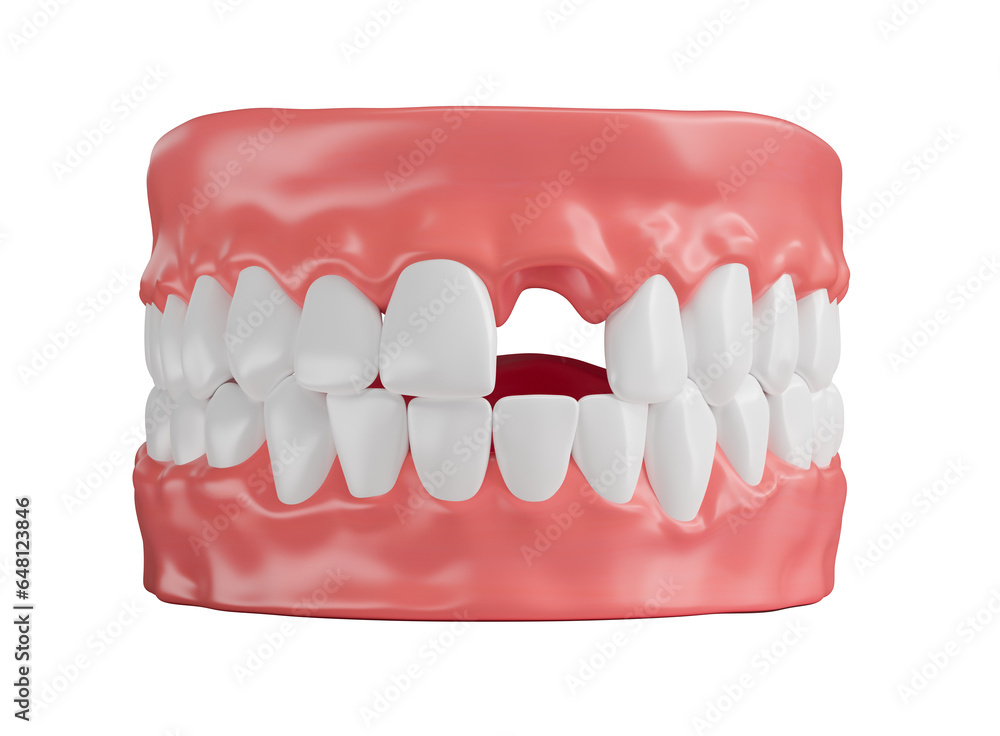 Realistic dental arch in on transparent background in 3d render Stock ...