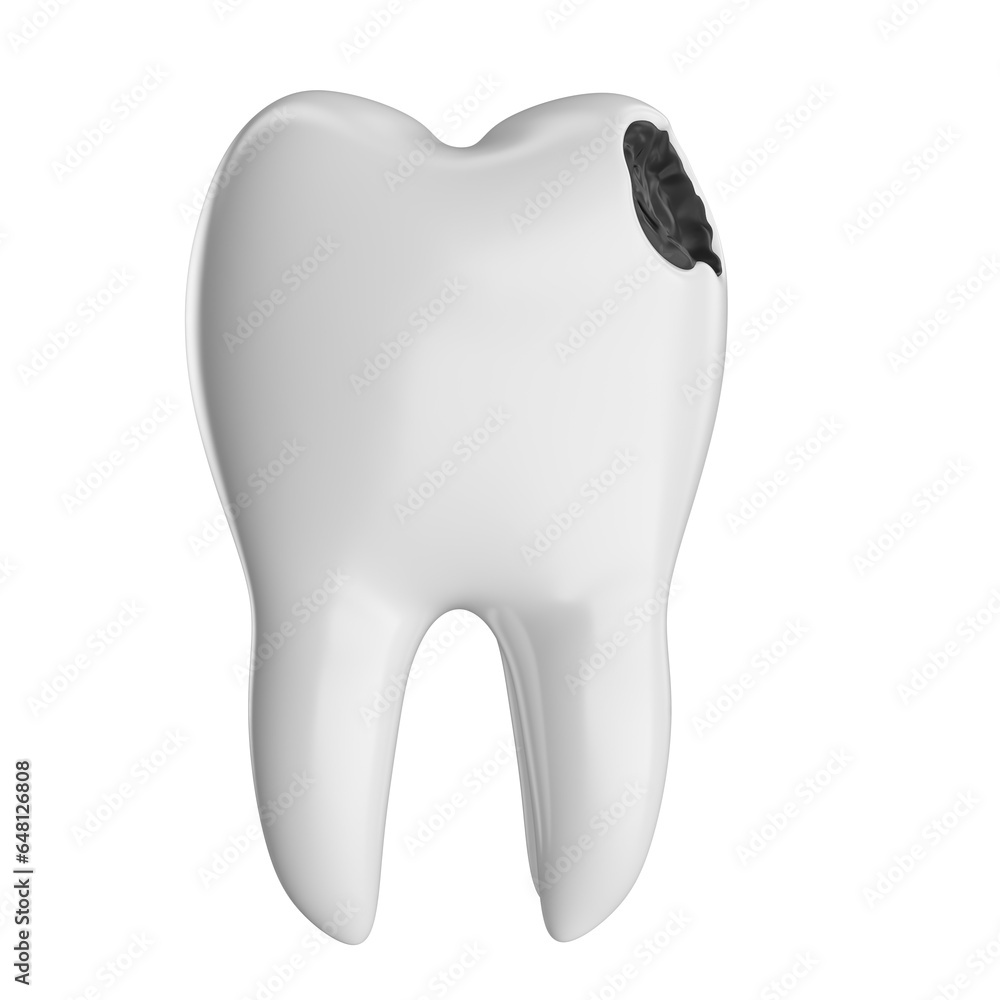 Realistic teeth with caries on transparent background in 3d rendering ...