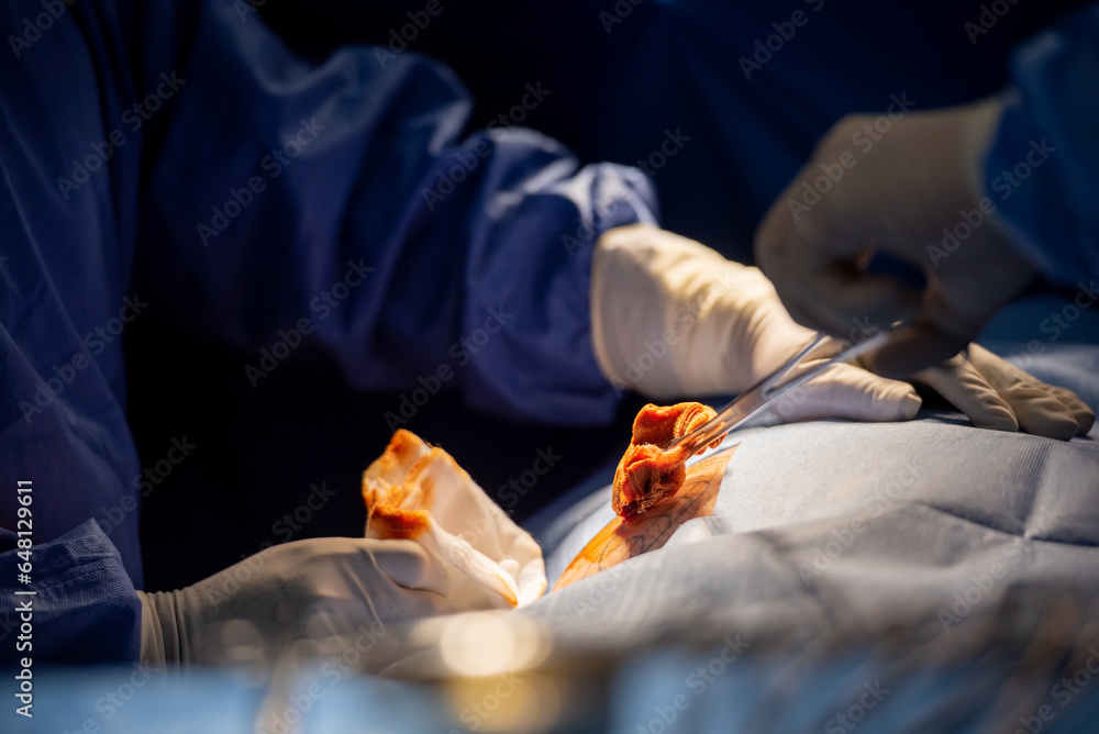 Hand of surgery doctor in Operating Room hold operating plier forceps ...