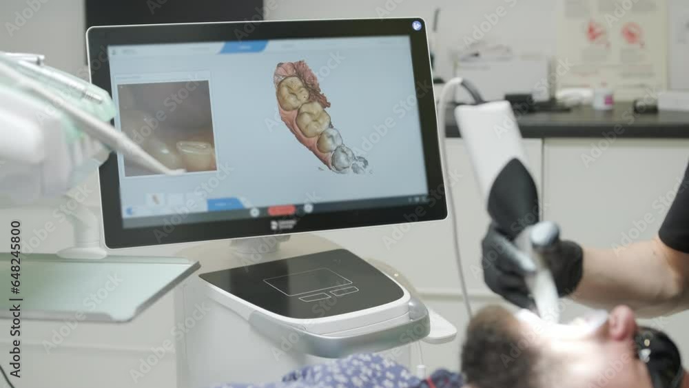 Doctor scans the patient's teeth in the clinic. The dentist holds in ...