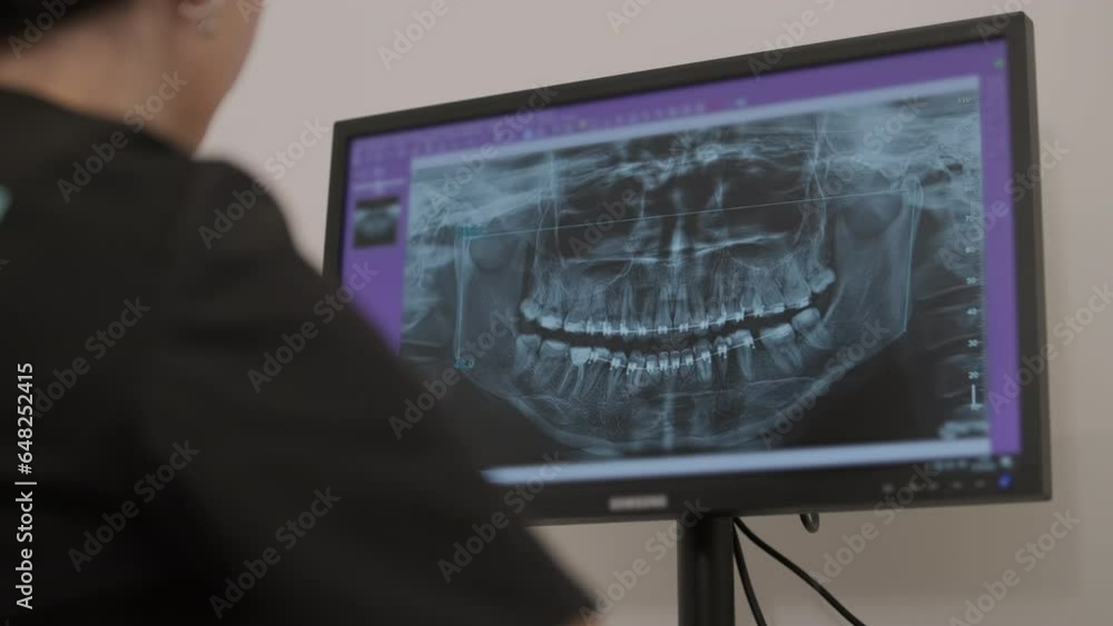 Dentist doctor examines a panoramic x-ray of the jaw on a computer ...