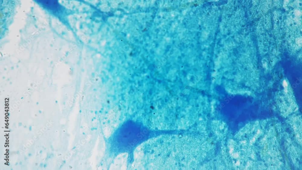 Macro footage of human motor neuron whole mount under microscope with ...