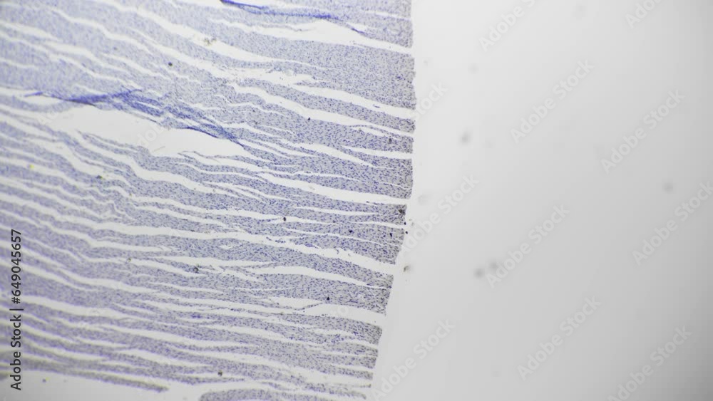 Myocardium in section magnified under light micrograph 40x on bright ...