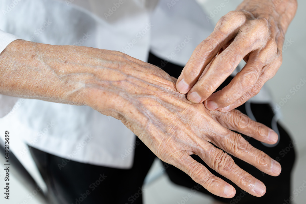 Elderly people scratching hand,itchy dry skin problem,poor circulation ...