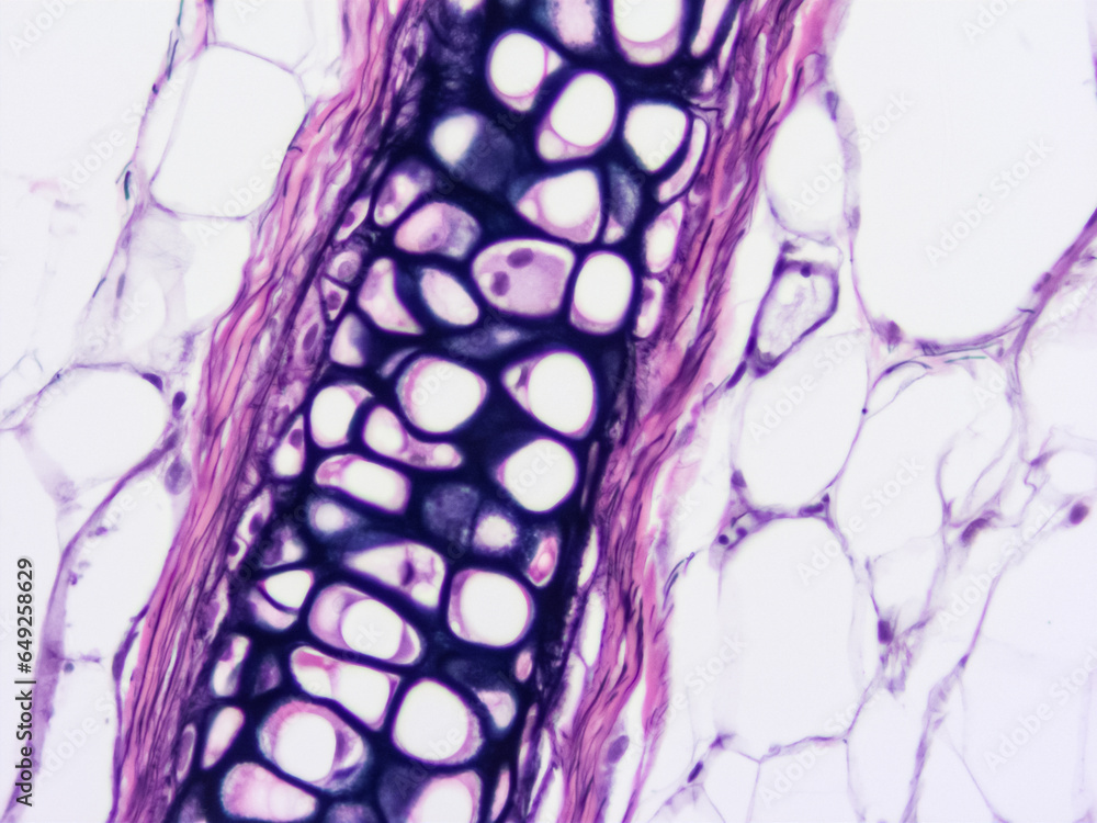 picture of histology human tissue with microscope from laboratory (not ...