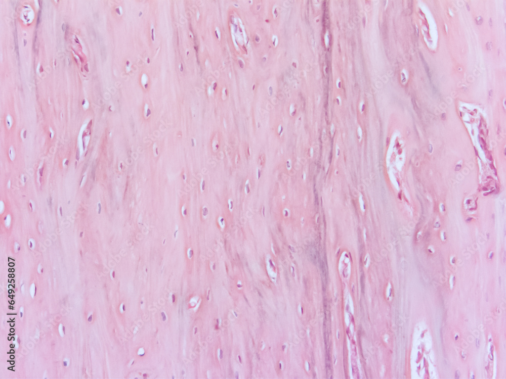 picture of histology human tissue with microscope from laboratory (not ...