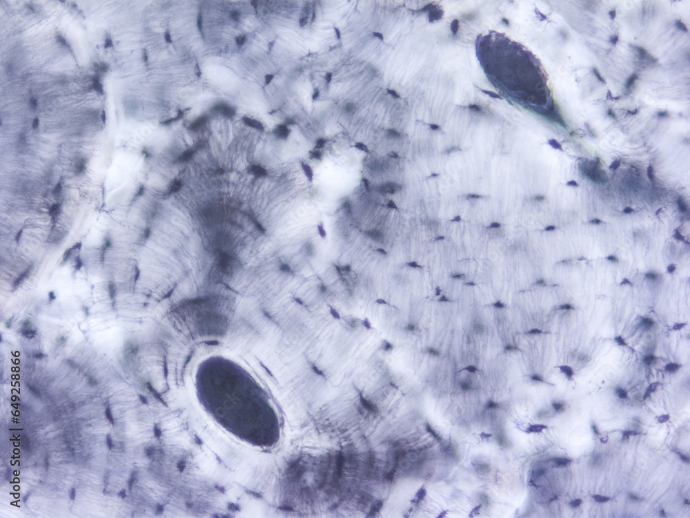 picture of histology human tissue with microscope from laboratory (not ...