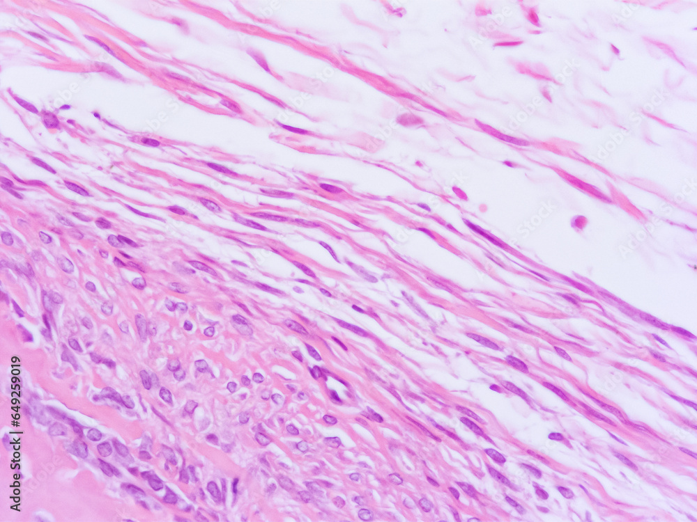 picture of histology human tissue with microscope from laboratory (not ...
