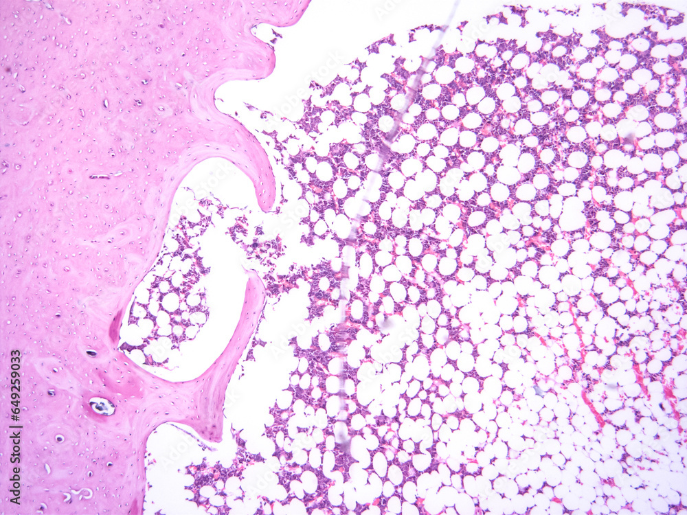 picture of histology human tissue with microscope from laboratory (not ...