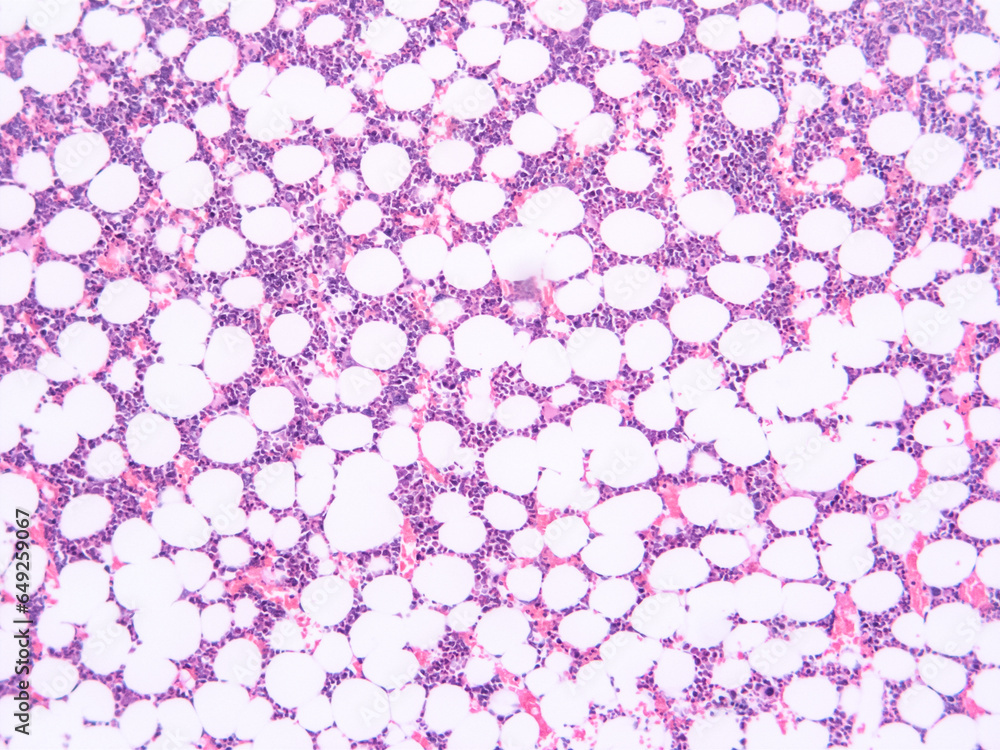 picture of histology human tissue with microscope from laboratory (not ...
