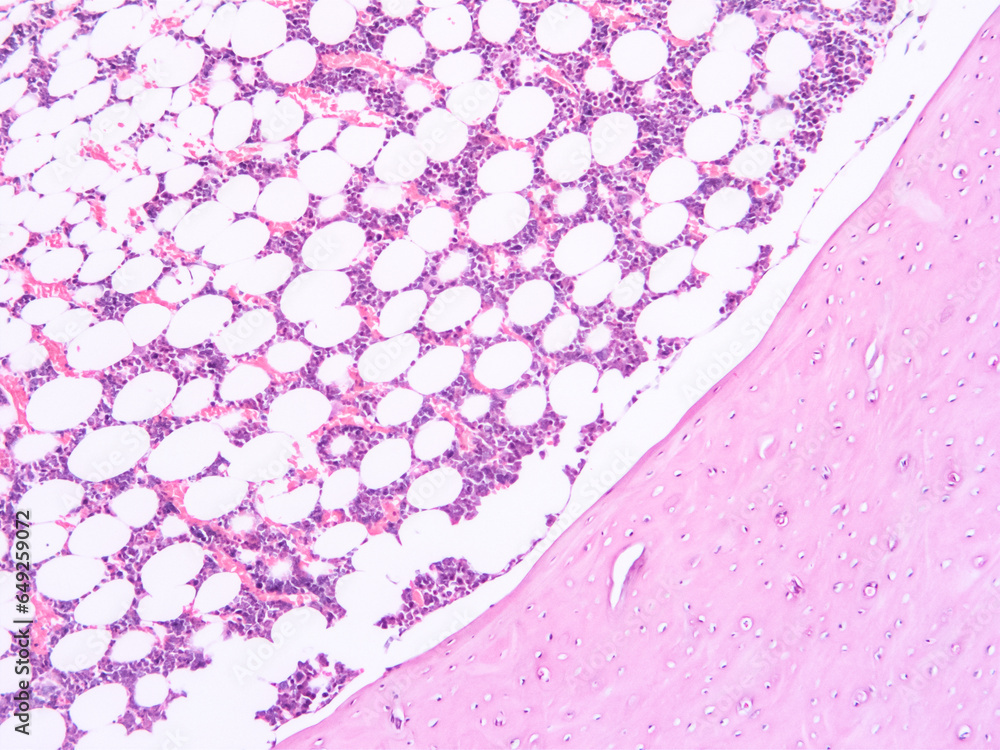 picture of histology human tissue with microscope from laboratory (not ...
