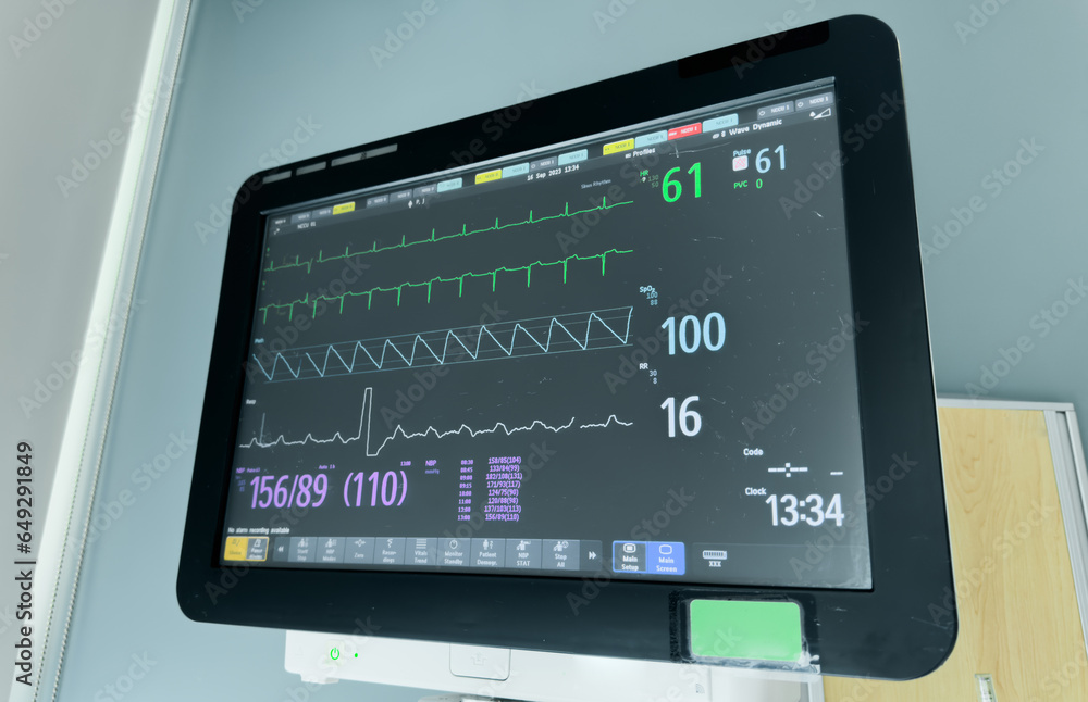 hospital monitor displaying vital signs like heart rate, blood pressure ...