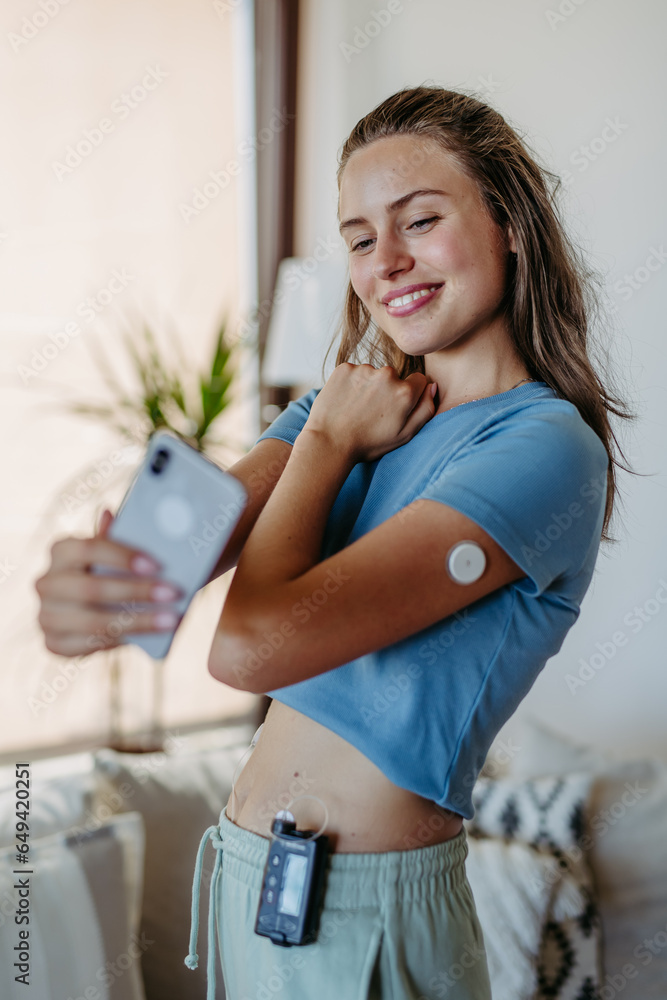 Beautiful diabetic girl taking a selfie, having an insulin pump and a continuous glucose monitor ...