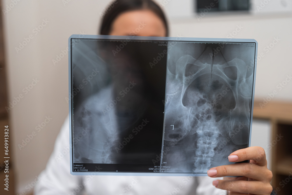 Radiographic close up: doctor radiologist holding X-ray film evaluating ...