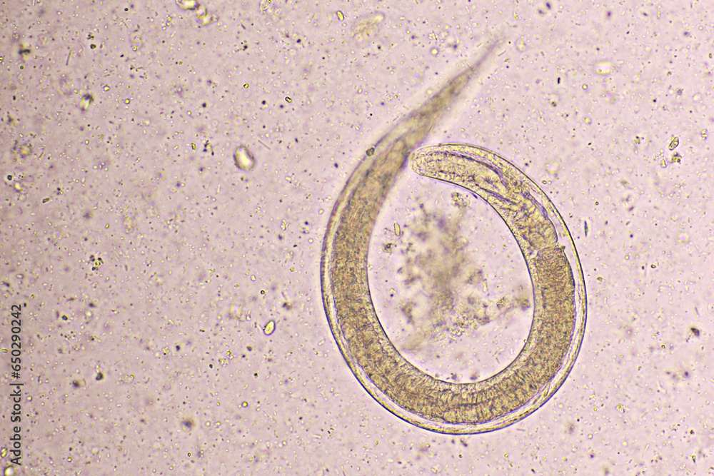 Poster Strongyloides stercoralis or threadworm in human stool, analyze ...
