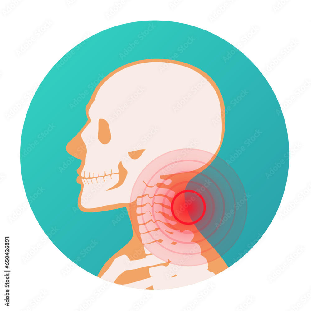 Red circle pain localization in the neck of the human body, skeleton ...
