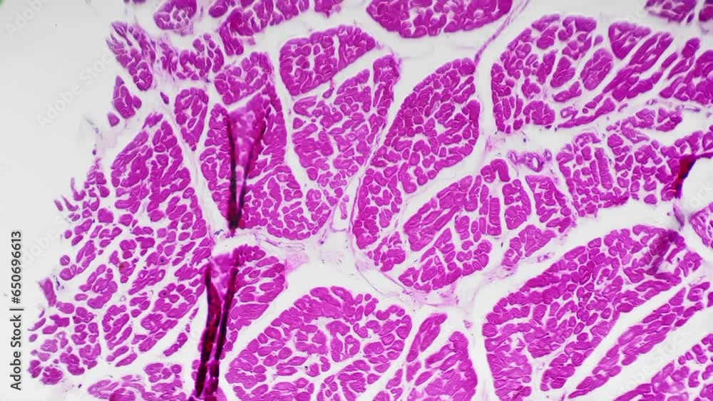 Large vein pattern in section filmed under microscope 100x on white ...