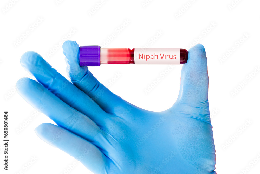 Nipah virus concept.Womans hand holding a glass test tube.Nipah ...