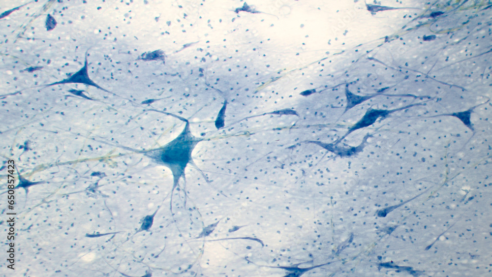 Pyramidal neurons. Pyramidal neurons. Spinal cord. Nissl stained. Stock ...