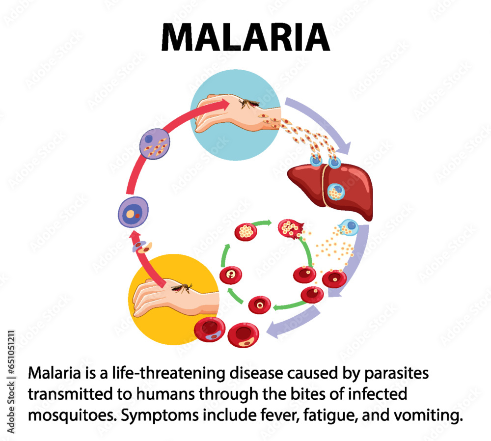 Life Cycle of Malaria Parasite: A Visual Guide Stock Vector | Adobe Stock