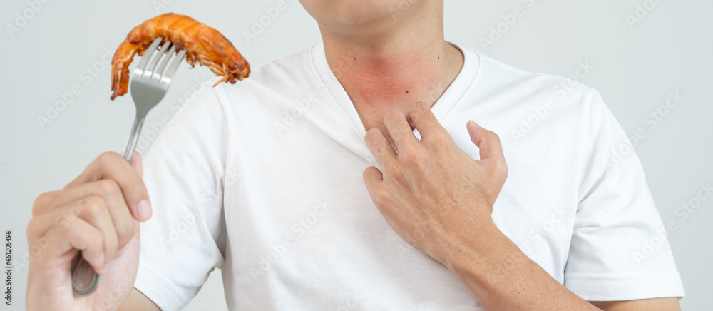 food allergies, men have reactions itching and redness after eating ...