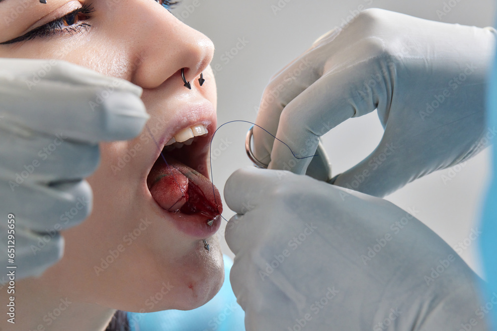 Foto de tongue splitting. cutting the tongue, one type of modification ...