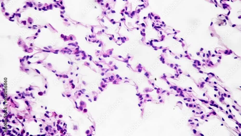 Macro footage of human bronchiolus in section filmed under microscope ...