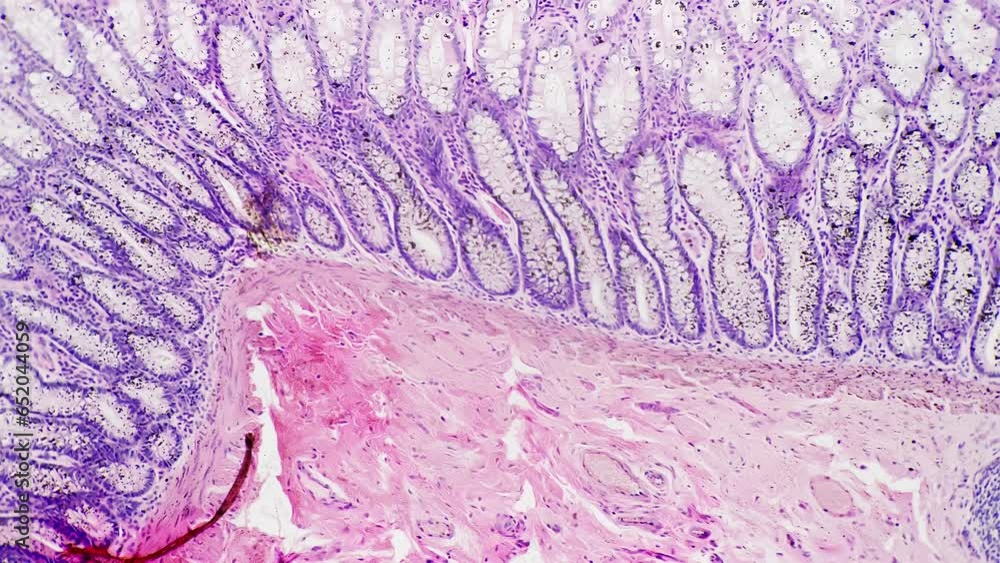 Human rectum tissue magnified under microscope in 100 times against ...