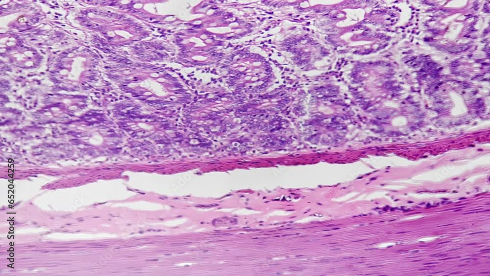 Large intestine of human being in section magnified under microscope in ...