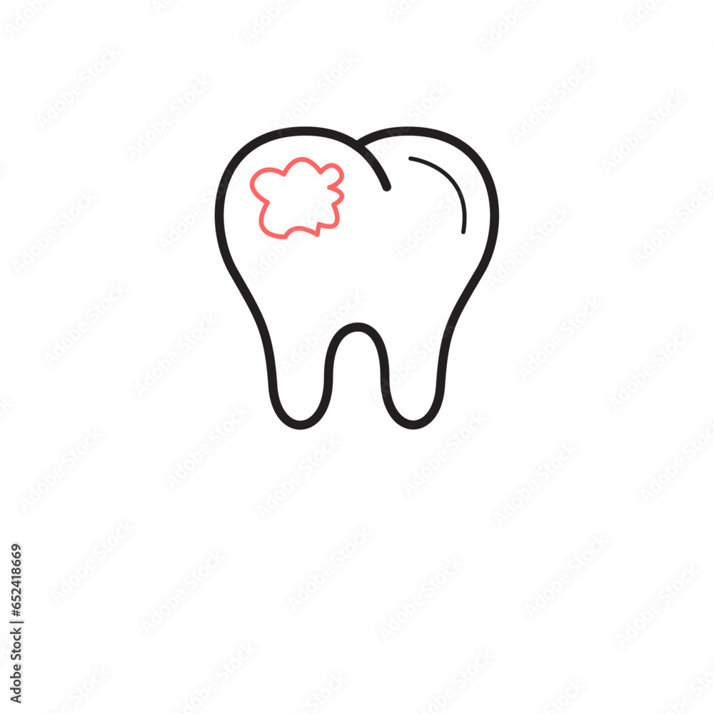 Hole in tooth, Cavity, Filling, cavity, caries, tooth decay. Stock ...