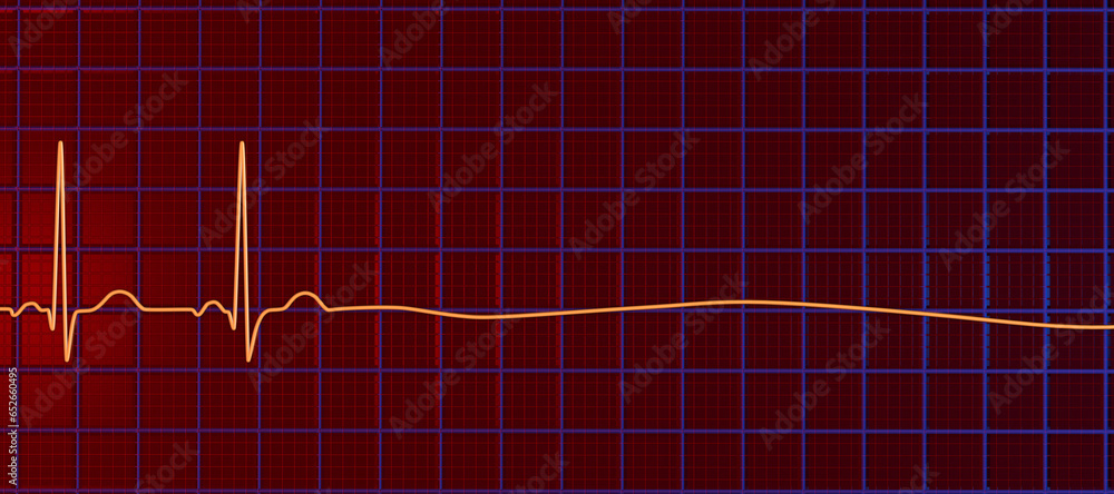 ECG in asystole, 3D illustration Stock Illustration | Adobe Stock