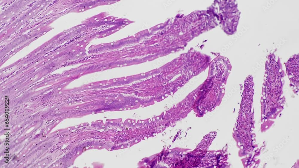 Human large intestine in section magnified under microscope in 100 ...