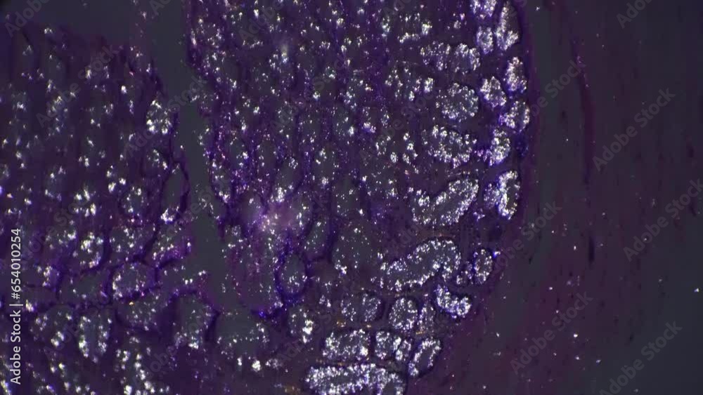 Piece of human rectum filmed with magnification 200x and cross light ...