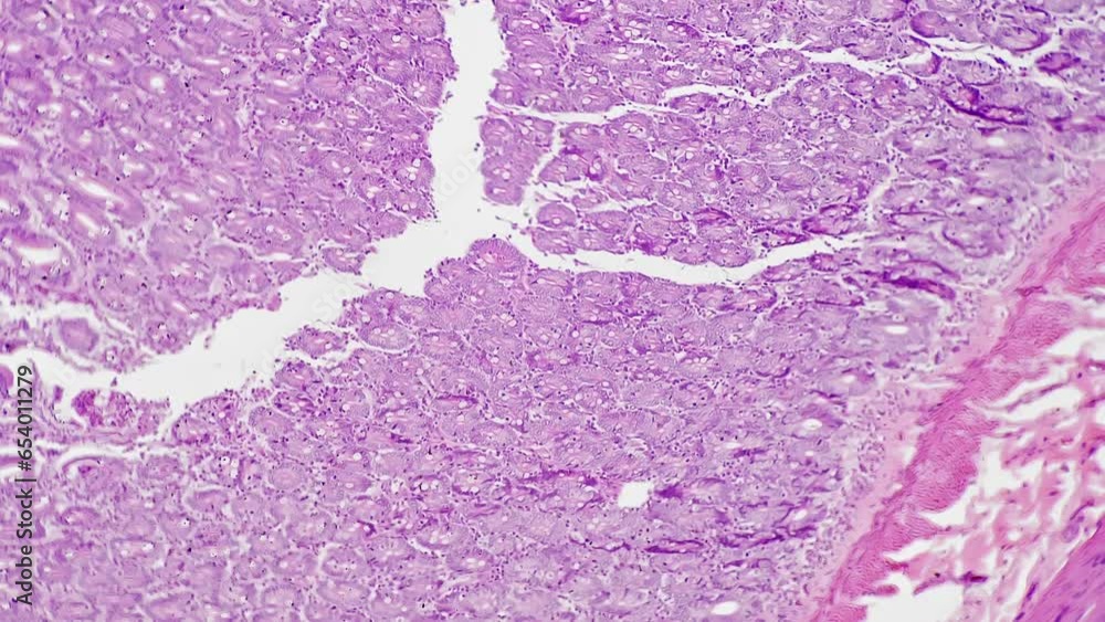 Section of human large intestine magnified under microscope 100x filmed ...