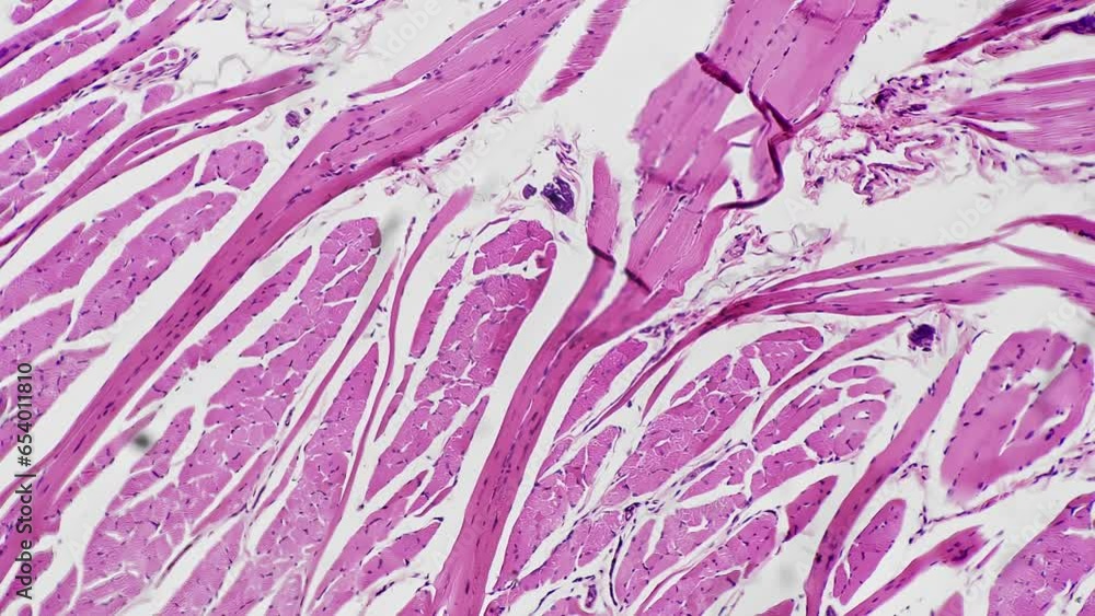 Human tongue in longitudinal section showing filiform papillae under ...